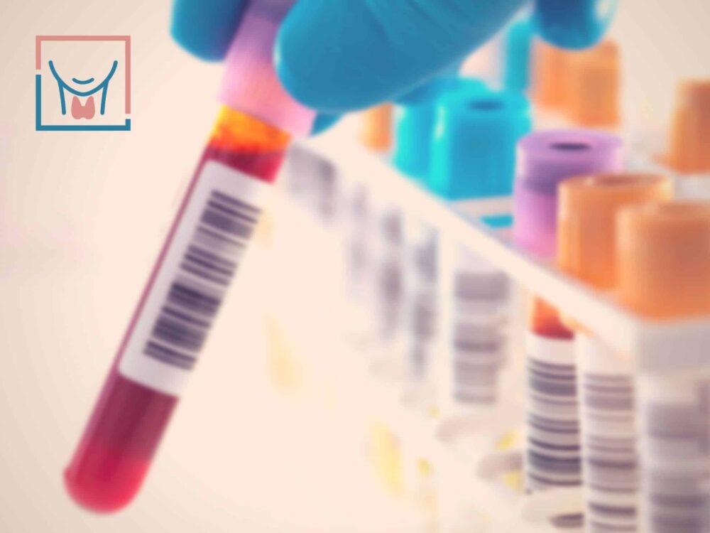 Dysuria (Painful Urination): Causes & Treatments